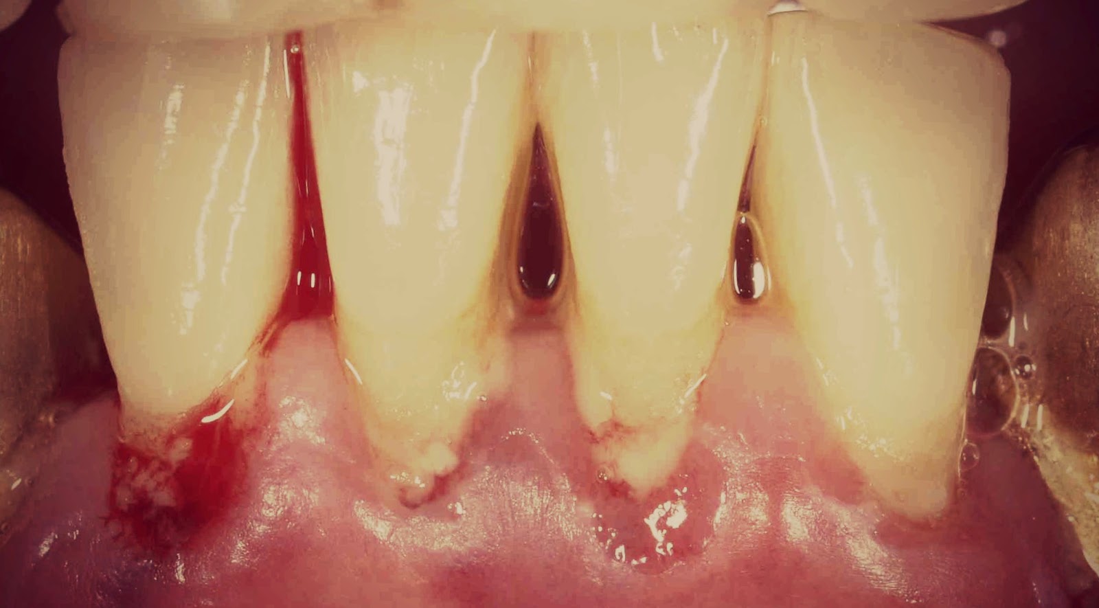 A Guide to Periodontology - TOOTH GERM