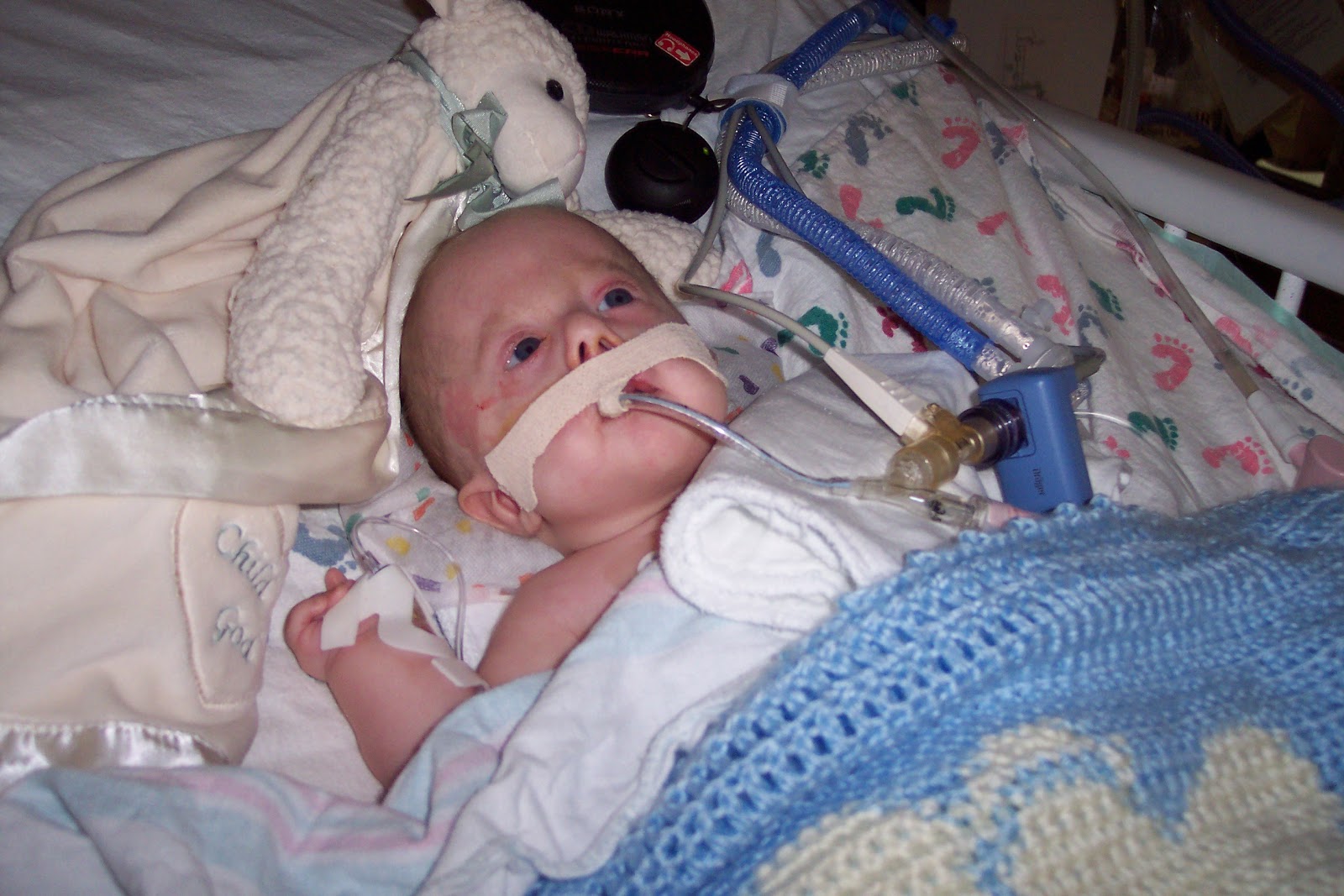 Compatible With Joy-Trisomy18: Good Times and Hard Times