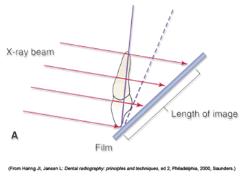Dentistry and Medicine: Intraoral Radiographic Techniques (The ...