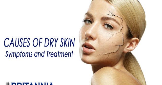 BRITANNIA MEDICAL CENTER - The Enclave: Causes of Dry Skin: Symptoms ...
