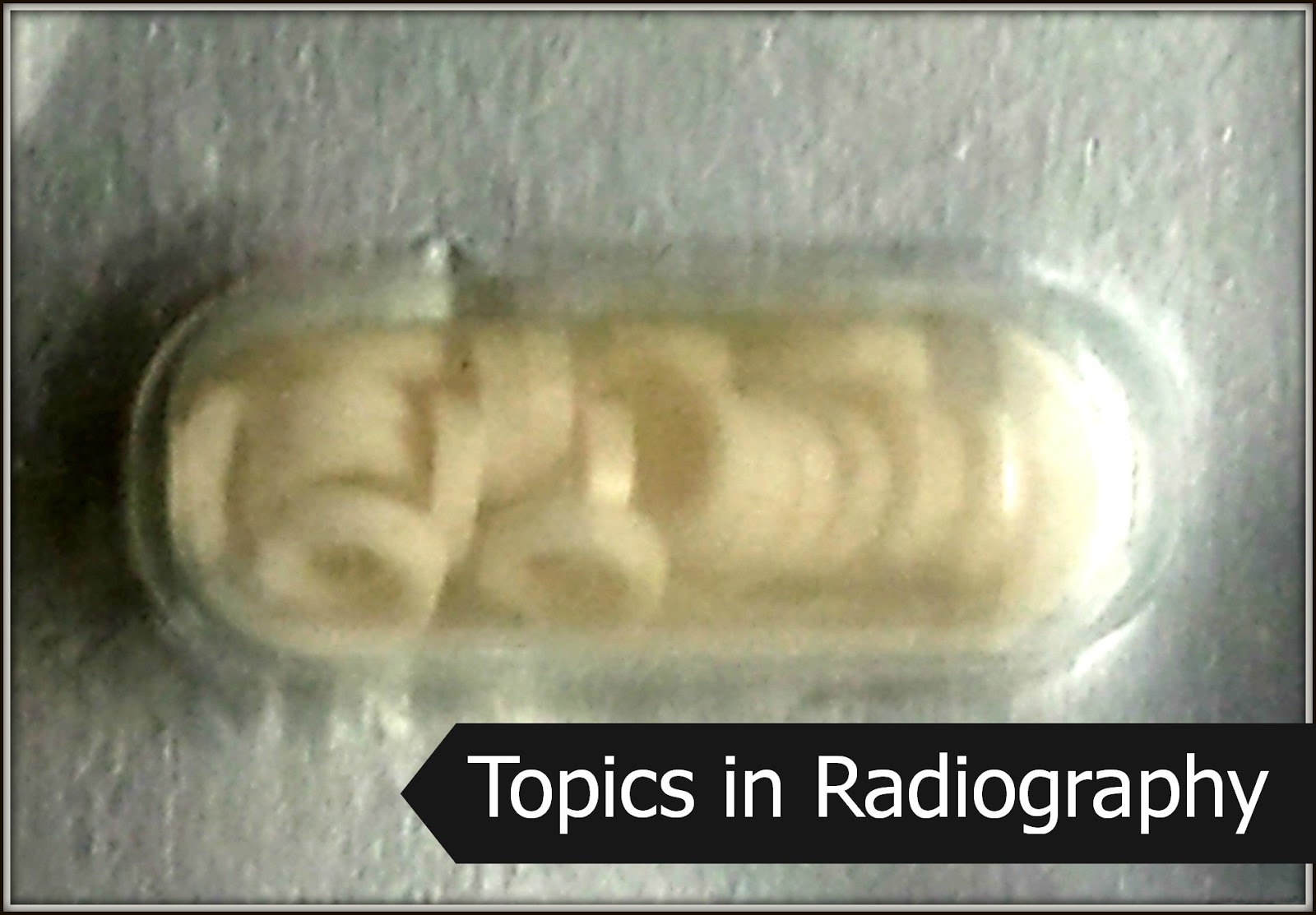 Topics in Radiography: Radiographic Sitzmarker Study