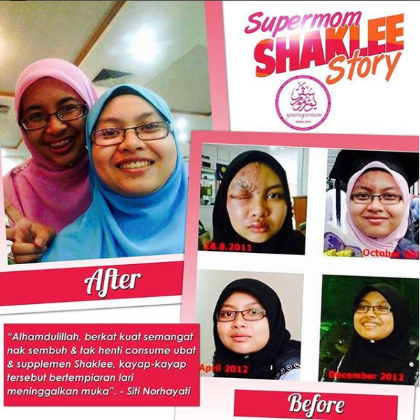 Tanda-Tanda Kayap dan Cara Merawat Kayap Dengan Berkesan - Pengedar ...