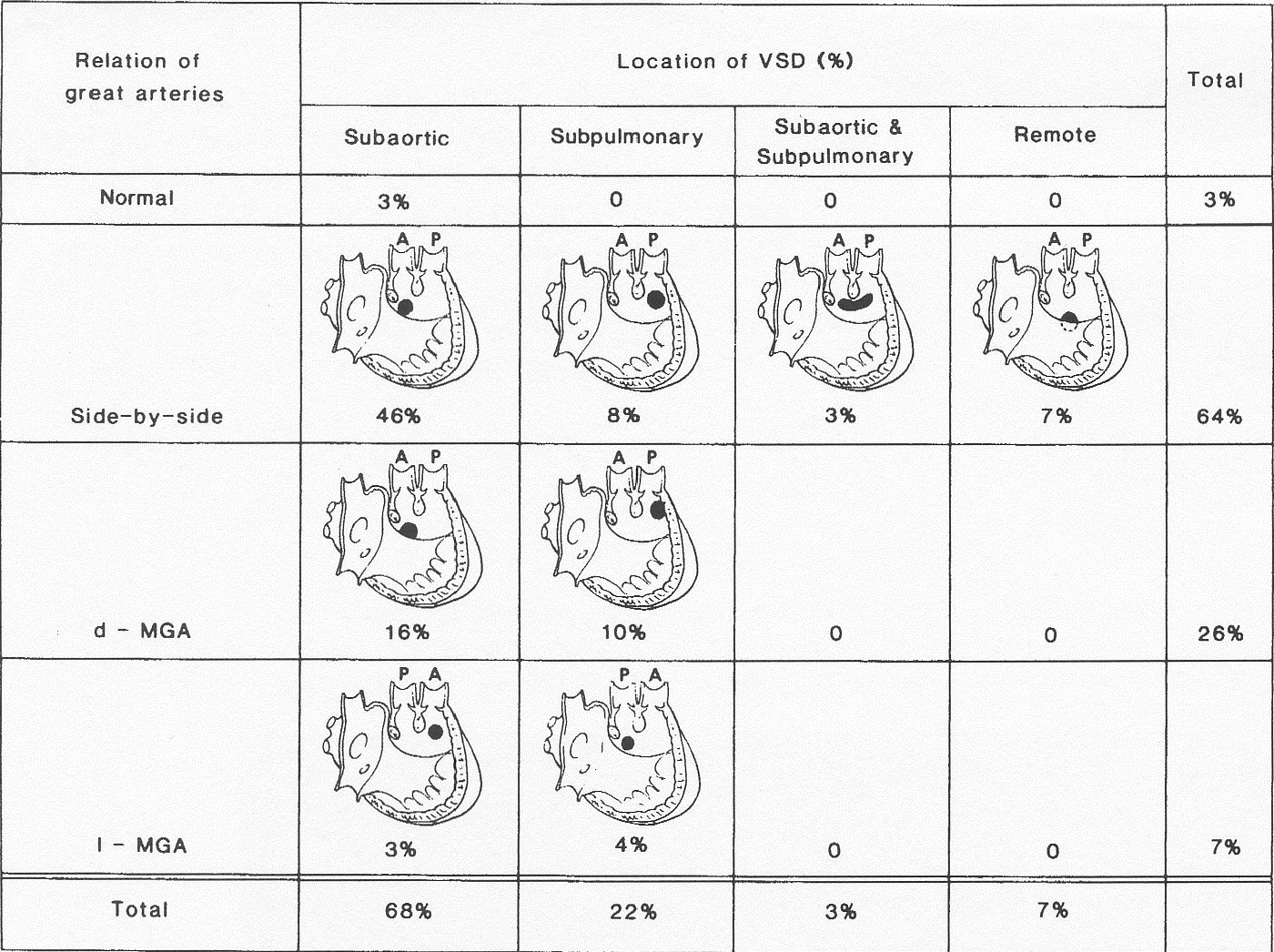 Pedi cardiology: DORV classification
