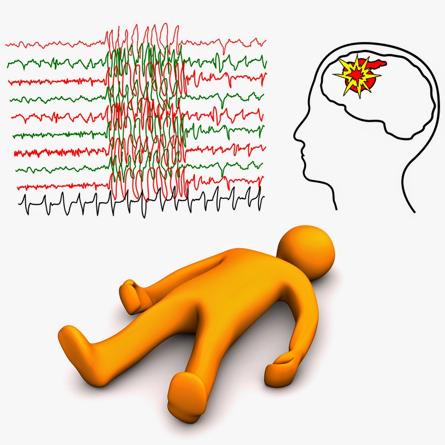 Medical Emergencies by Chathurika: Status Epilepticus