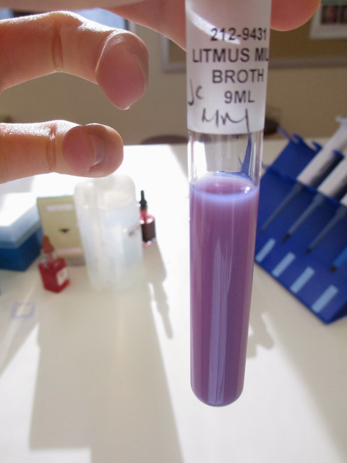 Franciscan Microbiology Lab: Test Results!!!