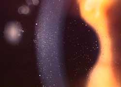 Tear Film Exchange: Just One More Reason RGP Contact Lenses May Be A ...