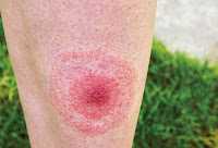 Ce que tu cherche : Pourquoi mon corps entier a-t-il mal?