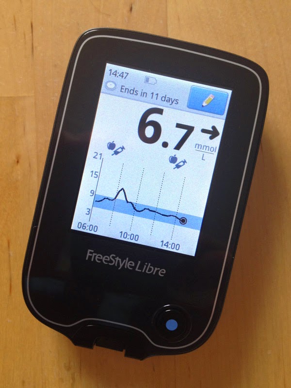 Abbott Freestyle Libre review - BG monitoring goes all flash