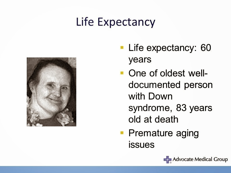 Williams Syndrome Life Expectancy