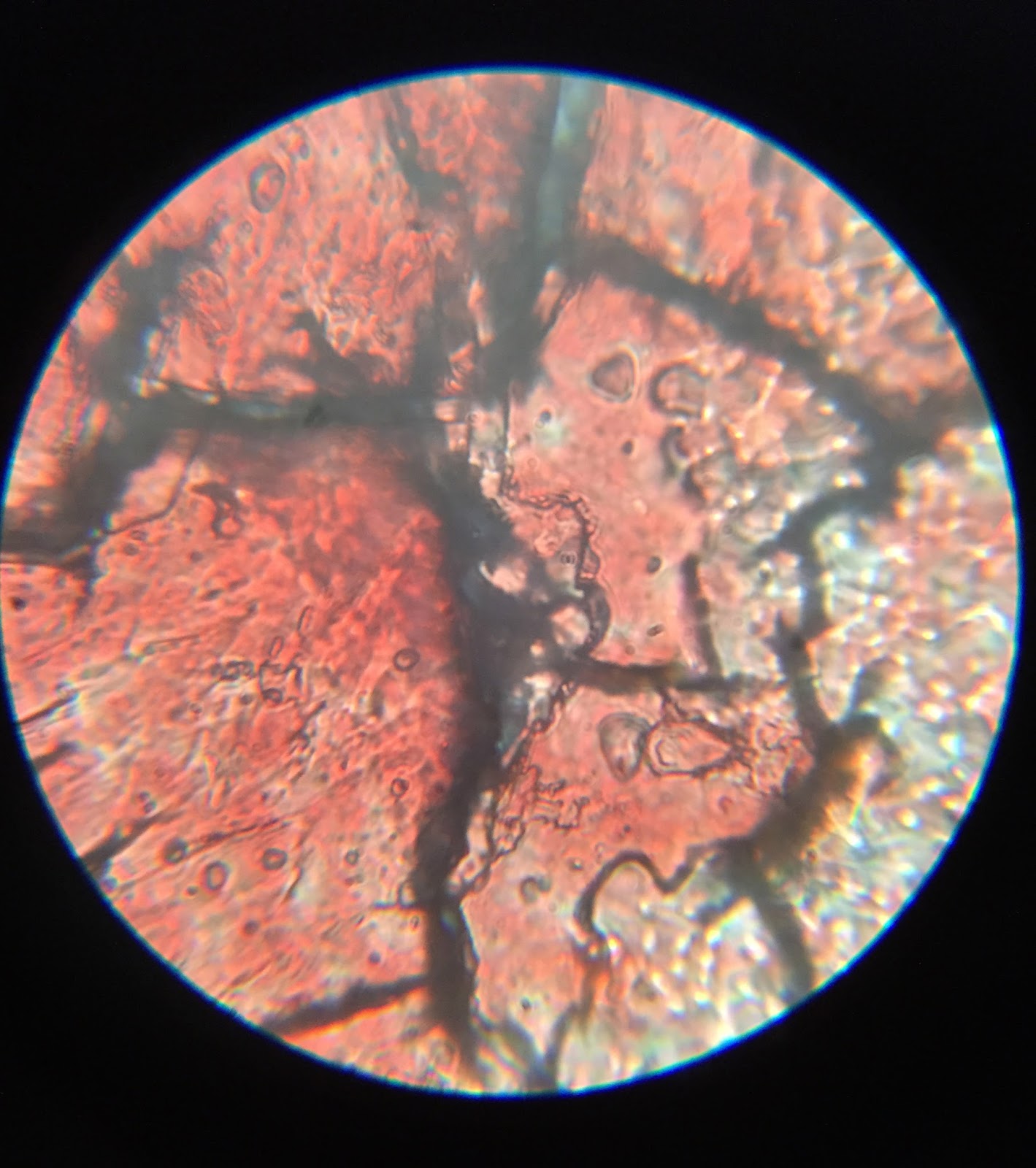 A school of fish: Blood Cells Under Microscope