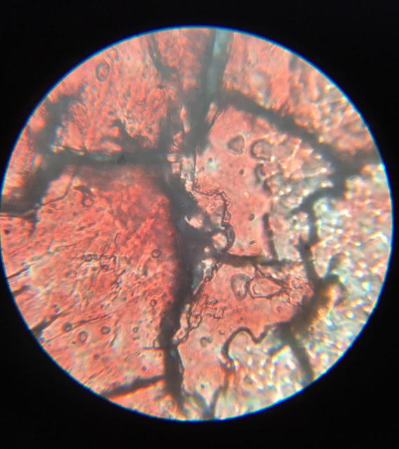 A school of fish: Blood Cells Under Microscope