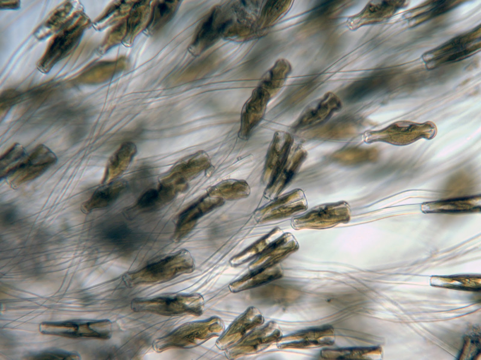 The Spread of Didymosphenia geminata