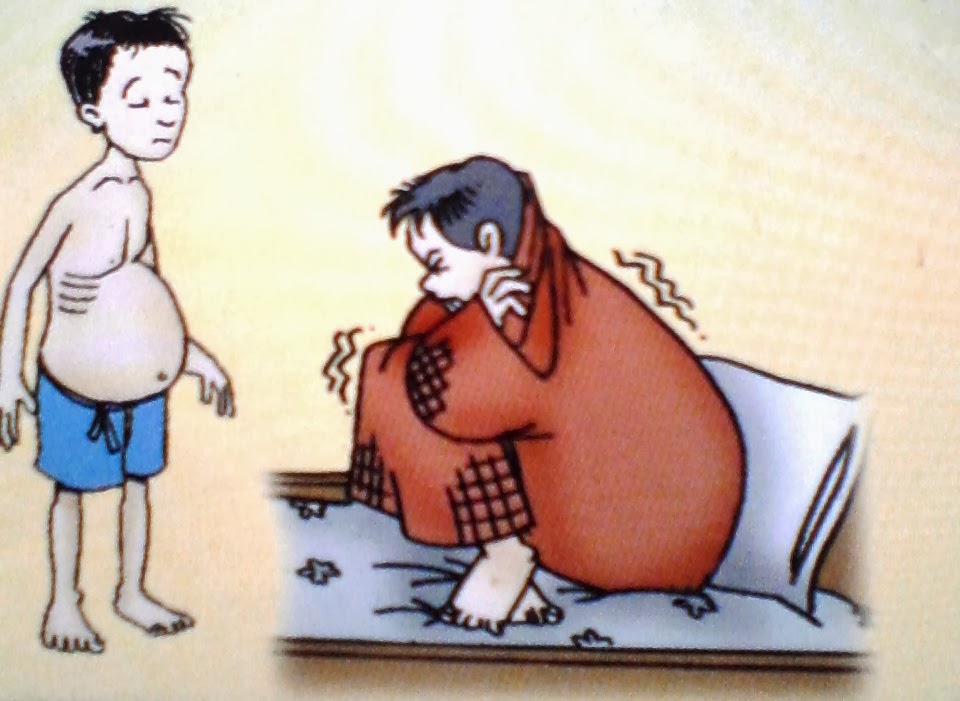 Simptom dan tanda kecacingan (Jangkitan cacing)