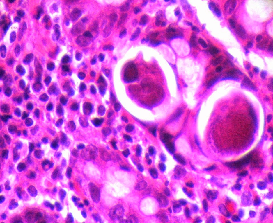 GASTROINTESTINAL AND LIVER HISTOLOGY PATHOLOGY ATLAS: DUODENUM ...