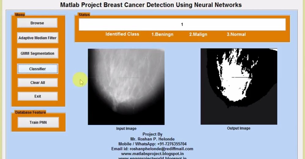 Breast Cancer Detection Using Neural Networks Matlab Project with Source Code ~ Low Price Projects