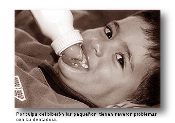 Estomatologia Integral "Hablemos entre dientes": La caries rampante o ...