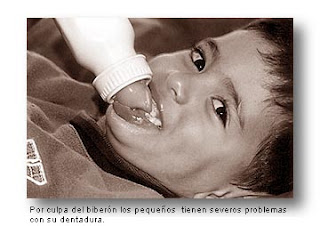 Estomatologia Integral "Hablemos entre dientes": La caries rampante o ...