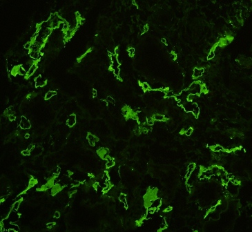 Renal Pathology Review: C4d revisited