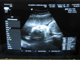 Bowo Prasetio: Prinsip Kerja USG