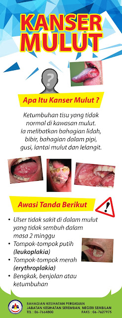 Blog Rasmi Bahagian Kesihatan Pergigian Negeri Sembilan: August 2017