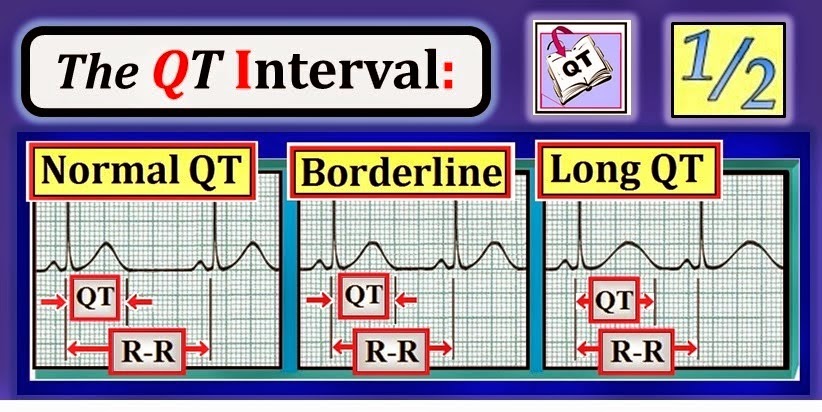 Interval QT | INA - ECG