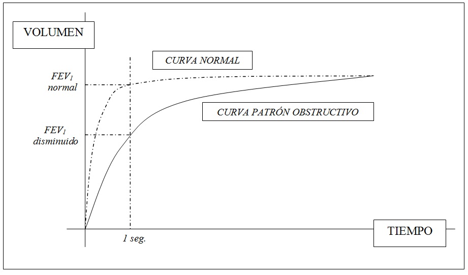 Fisioterapia Respiratoria