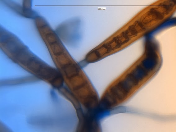 Fun With Microbiology (What's Buggin' You?): Exserohilum rostratum