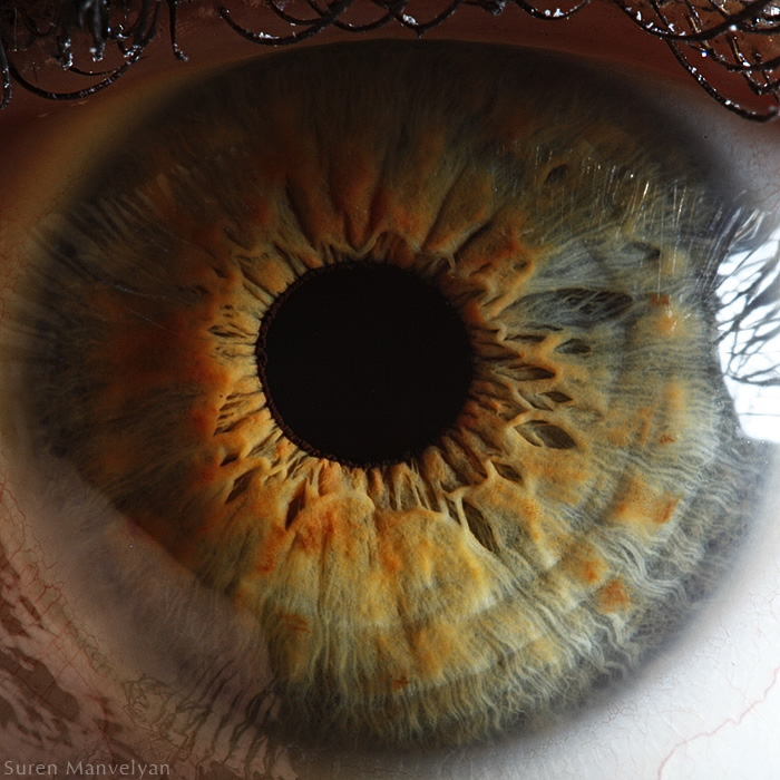 Modern & Multidimensional Iridology: Mixed/Biliary Iris Constitution ...