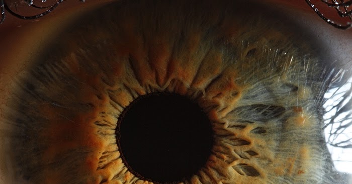 Modern & Multidimensional Iridology: Mixed/Biliary Iris Constitution ...