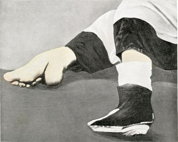 iGordo.net: Chinese foot binding