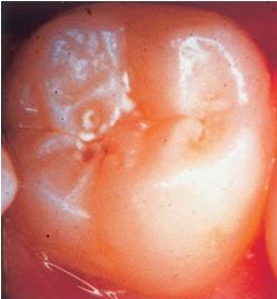 Dentistry lectures for MFDS/MJDF/NBDE/ORE: A Note on Clinical and ...