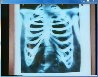 Thank you for your attention: The Man with X-Ray Eyes