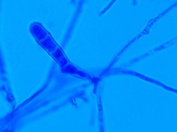 Fun With Microbiology (What's Buggin' You?): Epidermophyton floccosum