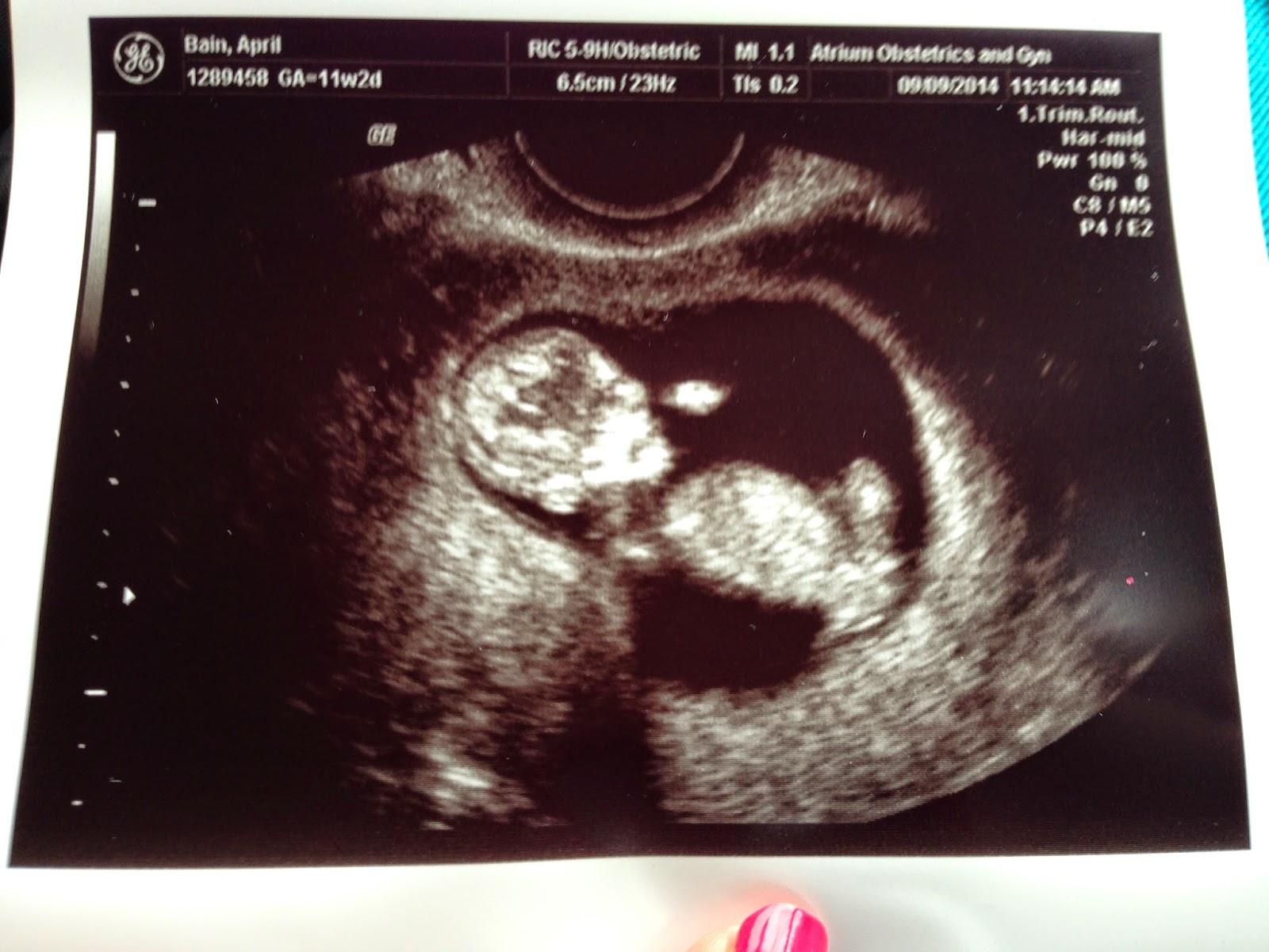 Carolina Belle: My Pregnancy So Far...