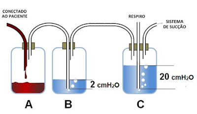 O Guia do Fisioterapeuta: Como funciona o dreno de tórax.