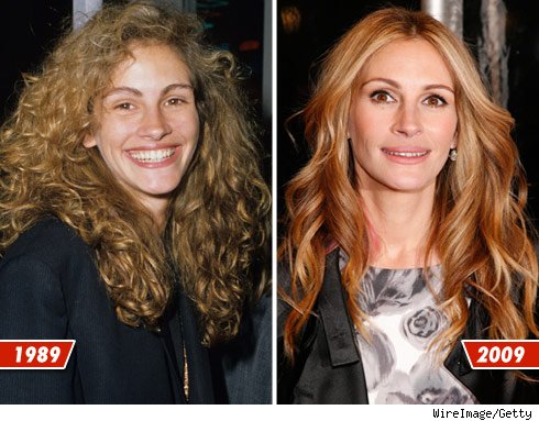 Julia Roberts Plastic Surgery Before and After Nose Job and Facial ...