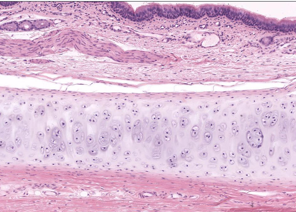 μicroscopia: TRACHEA, ESOFAGO E TIROIDE