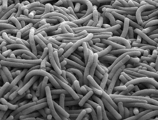 Lactobacillus bulgaricus