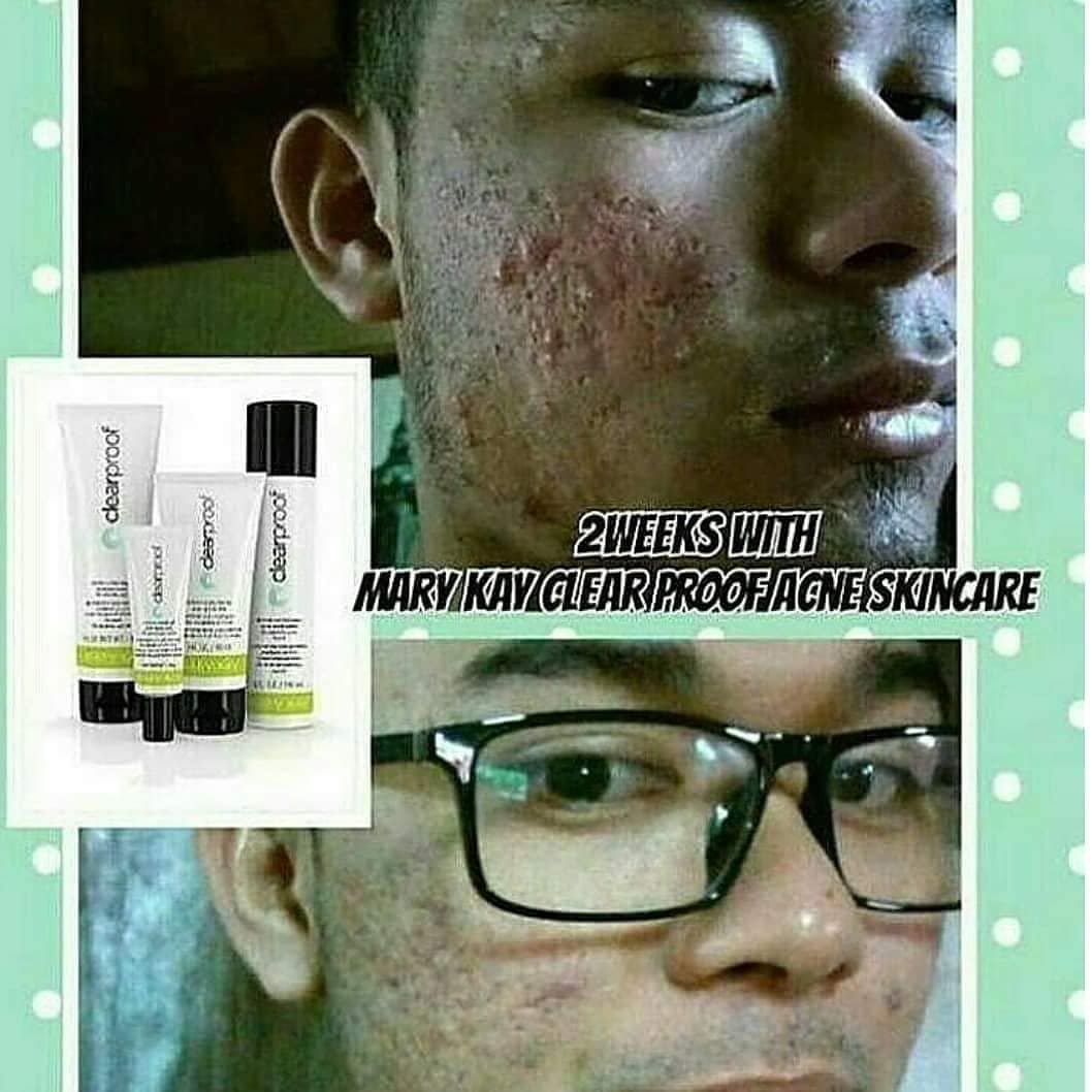 Set Untuk Muka Breakout - Tips Kurus Cepat Dan Berkesan