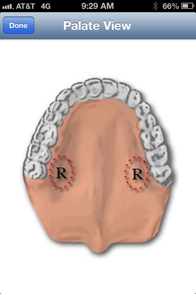 Major Speech Pathology Fun with a Side of Gluten Free: Thank Goodness ...
