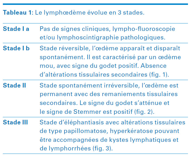 S'informer sur le lymphoedème: Diagnostic et prise en charge du lymphoedème