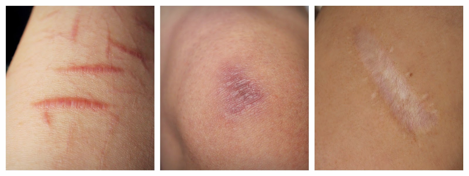 Ein bisschen blau: Ich habe mit einem Unterwasserdinosaurier gekämpft