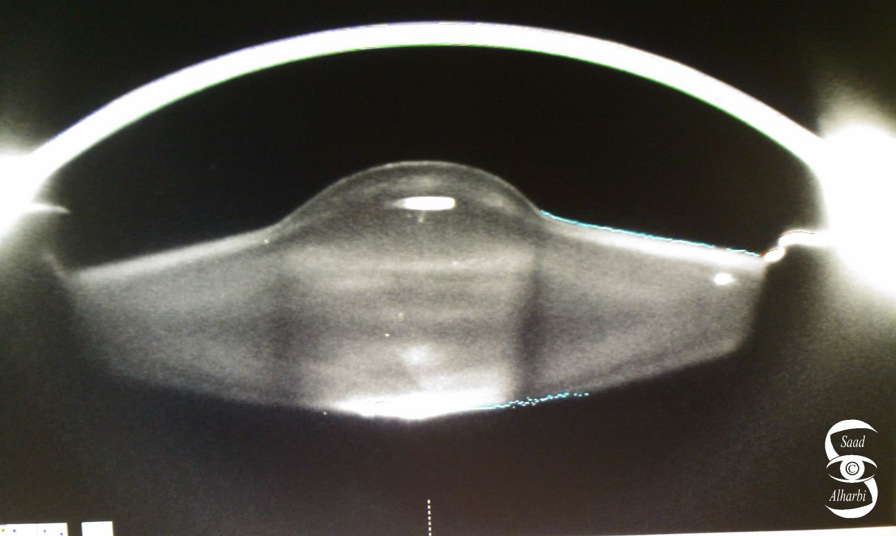 Ophthalmology مدونة السنا: Update of Ophthalmology Atlas