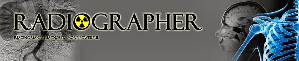 RADIOGRAPHER: 07/20/13