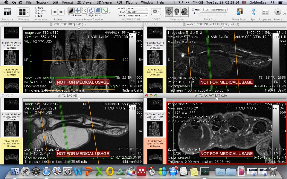 MRI and Medical Imaging: Extremities MRI scanners: exquisite, fast and ...