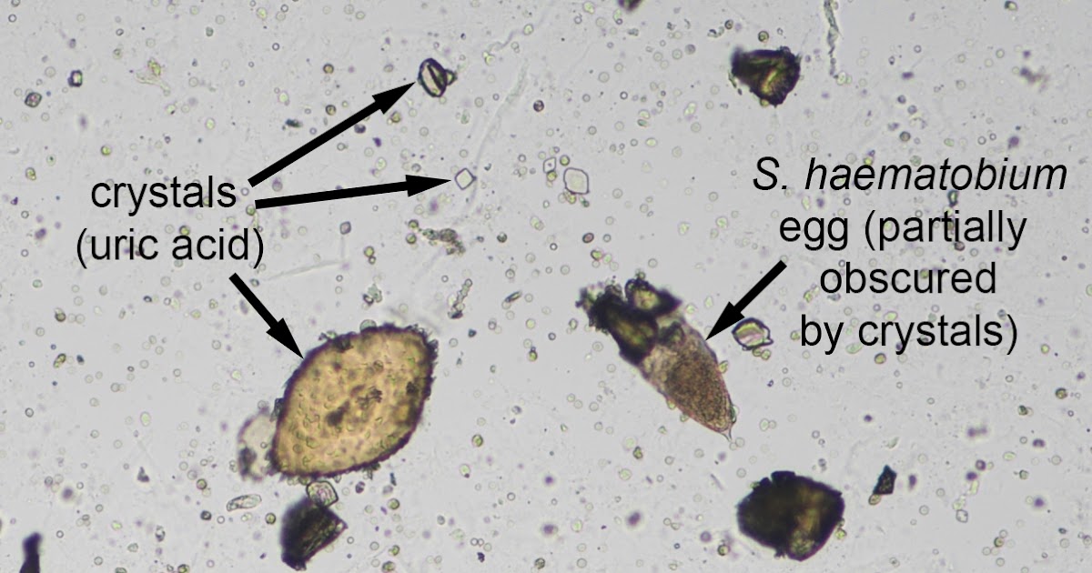Creepy Dreadful Wonderful Parasites: Answer to Case 511