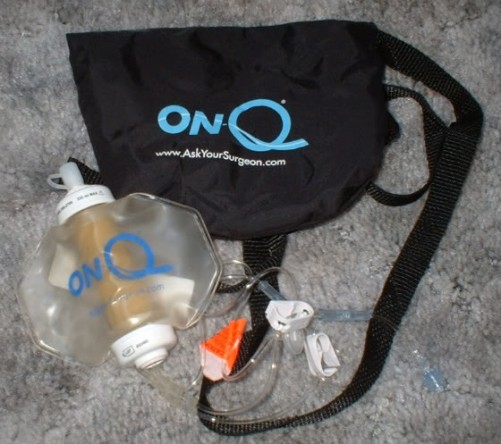 Jen's Journey From PHAT to PHABULOUS: FLASHBACK: My tummy tuck surgery.