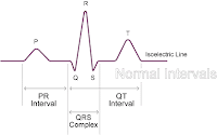 Learning how to read electrocardiograms (EKGs): PR, ST, QT