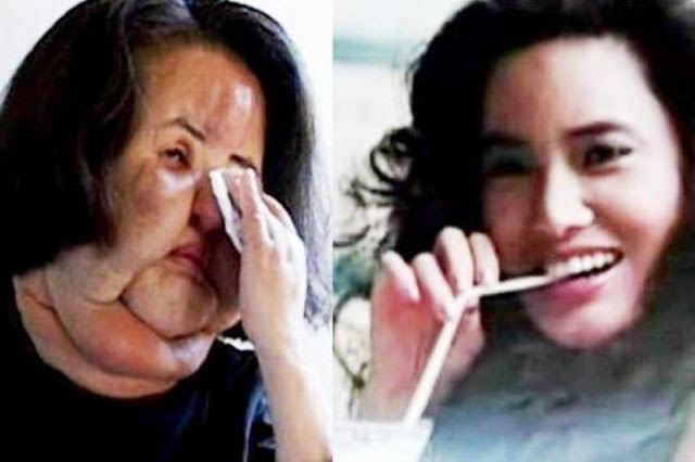 Hang Mioku, Plastic Surgery Addict Injects Cooking Oil Into Her Face ...