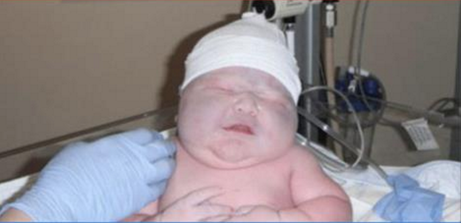 World Guinness Record In Boston World’s Biggest Baby Girl Ever Born ...